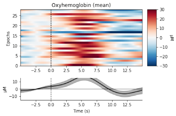 MNE/Python-fNIRS近红外数据处理中文手册 - 知乎