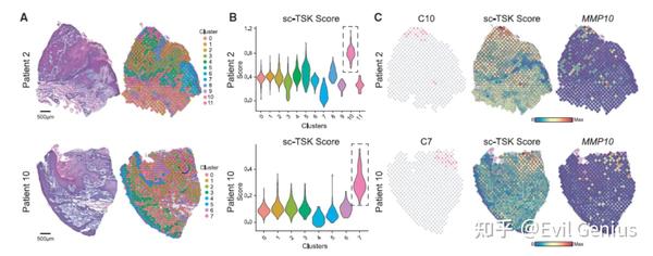 空间转录组基础分析之整合篇 - 知乎