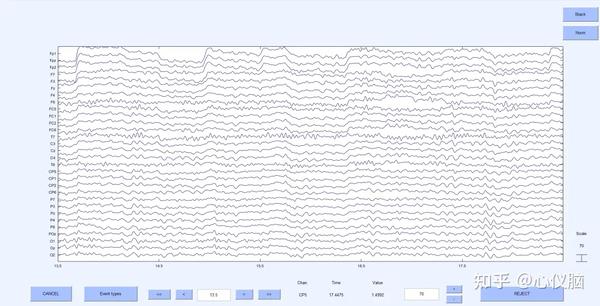 无需代码！图文并茂详解EEGLAB中的ERPs数据分析方法 - 知乎