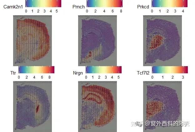 10X空间转录组 | Seurat 分析Visium空间转录组代码实操 - 知乎