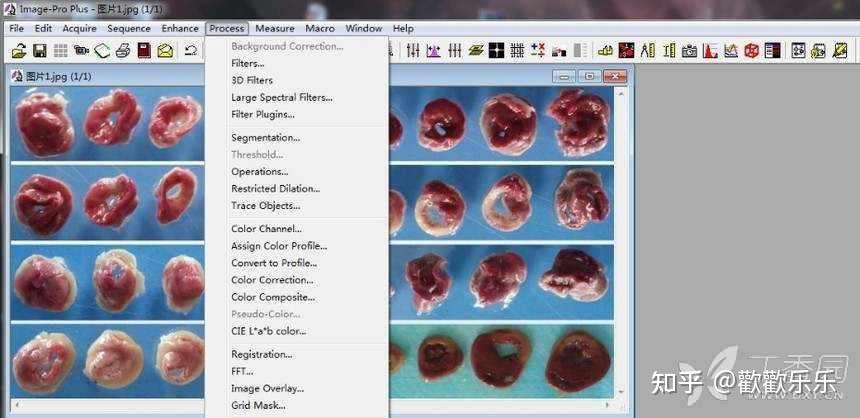 基础医学实验：TTC染色详细计算分析过程，步骤详解（组图） - 知乎