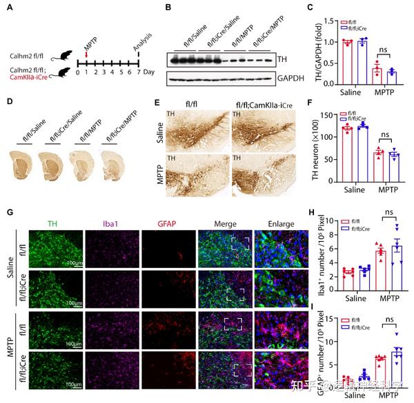Sci Adv+Theranostics︱军事医学研究院袁增强/中央民族大学程金波团队揭示钙稳态调节蛋白Calhm2调控神经退行性疾病新机制 - 知乎