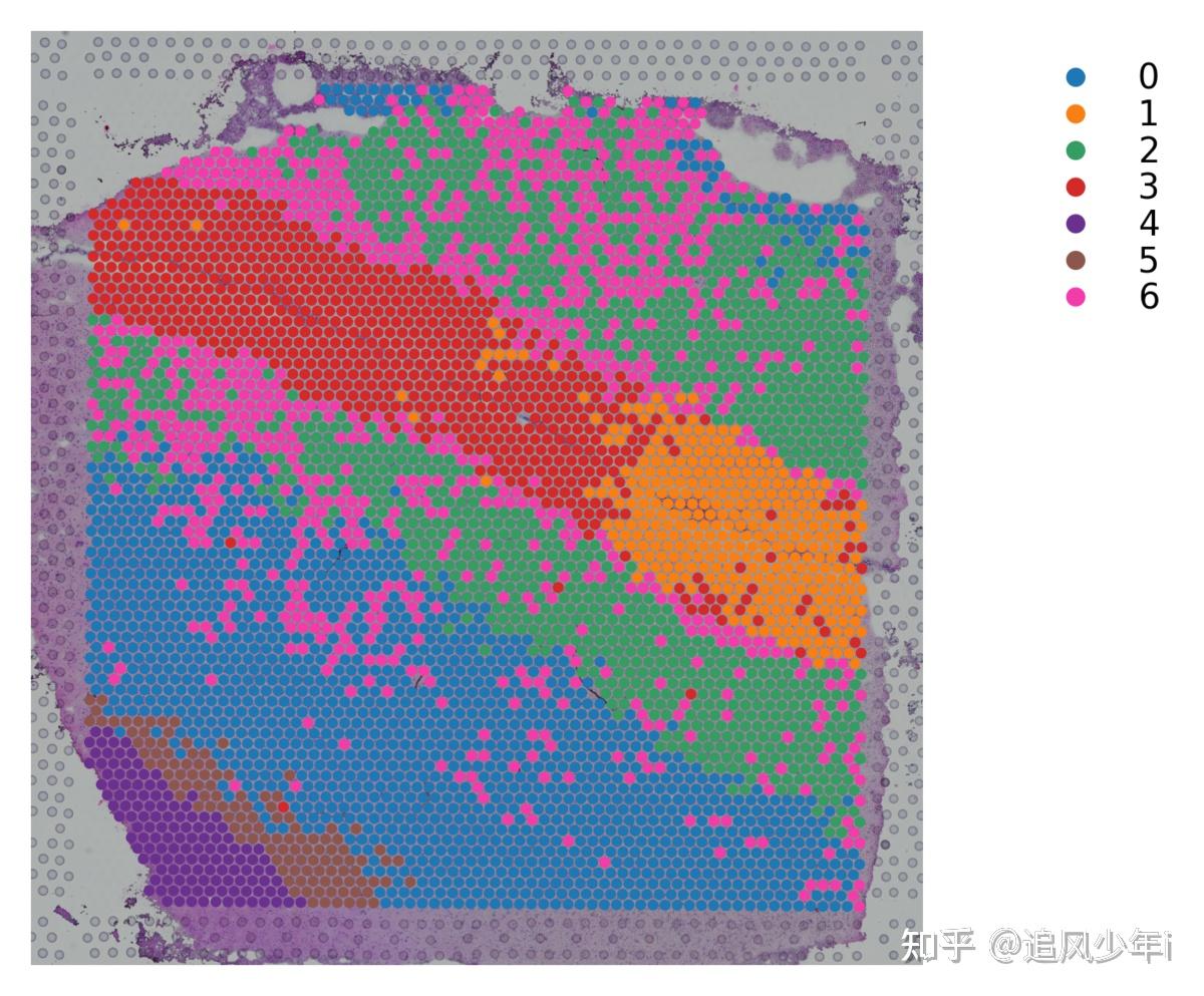 10X单细胞空间回顾之stlearn - 知乎