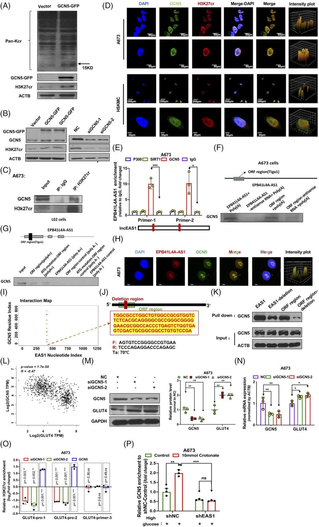 CTM | 清华大学深圳国际研究生院张雅鸥教授团队巴豆酰化/乙酰化修饰研究揭示Ⅱ型糖尿病抑制新靶点 - 知乎