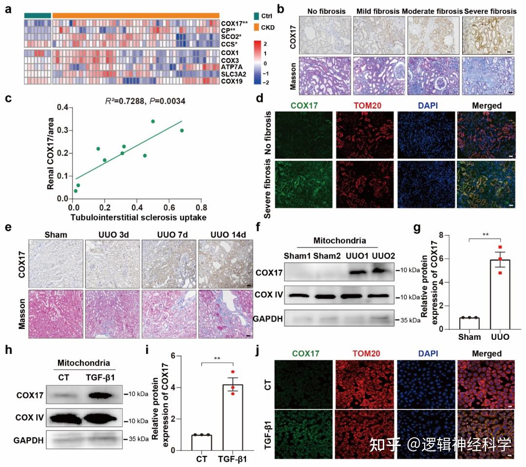 APS︱同济大学附属同济医院余晨团队揭秘线粒体内铜过载对肾脏纤维化的作用及调控机制 - 知乎