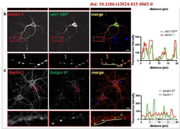 手把手教会荧光共定位分析 - 知乎