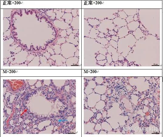 动物疾病模型案例之COPD - 知乎