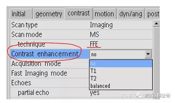 磁共振序列解析之——FFE序列分类 - 知乎