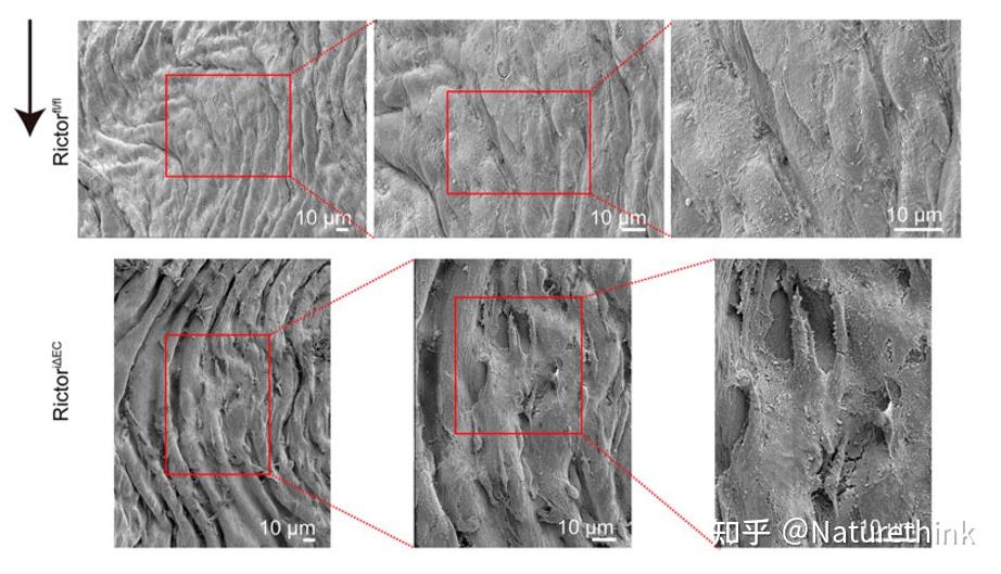 Rictor 在剪切应力下保持内皮完整性 - 知乎
