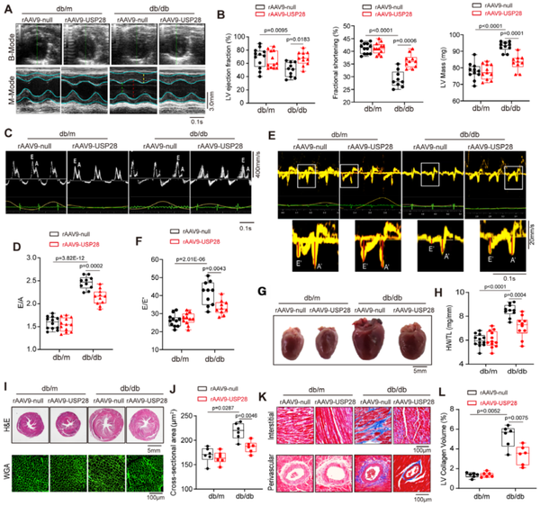 喜讯 | Circulation（IF:37.8）ChIP-seq+RNA-seq助力解析USP28在糖尿病性心脏病的调控机制 - 知乎