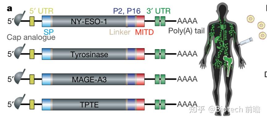 柳叶刀丨mRNA-4157联合K药辅助治疗黑色素瘤II期研究 - 知乎