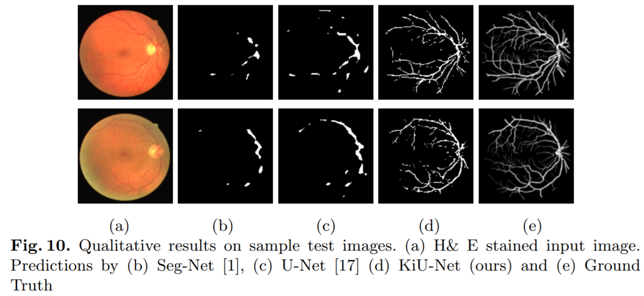 【论文速递12-21】医学影像分割方向优质的论文及其代码 - 知乎
