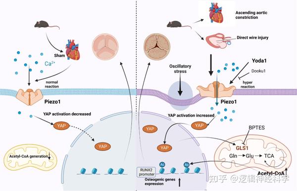 Sci Adv︱南方医科大学曾庆春/许顶立团队揭示Piezo1通过调控谷氨酰胺代谢促进钙化性主动脉瓣疾病发生发展的新机制 - 知乎