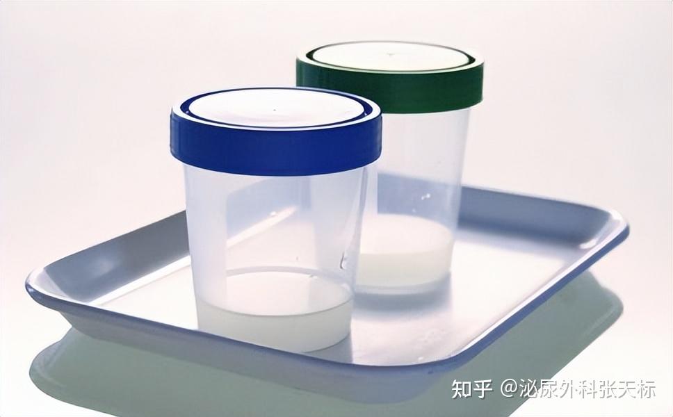 健康男性的精液,应该是这样的 知乎