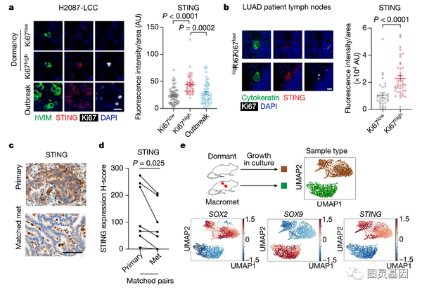Nature | STING抑制肺腺癌休眠转移的再激活 - 知乎