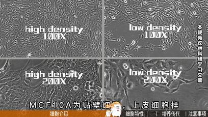 MCF10A细胞培养，人乳腺上皮细胞培养攻略 - 丰晖生物 - 知乎
