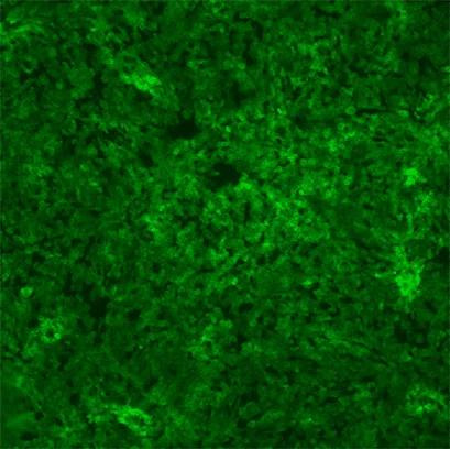 如何使用钙成像研究细胞信号转导|ibidi实验应用 - 知乎