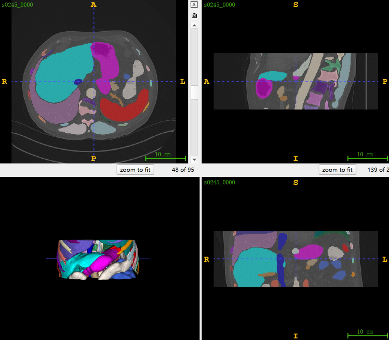 TotalSegmentator v2 数据集介绍 - 知乎