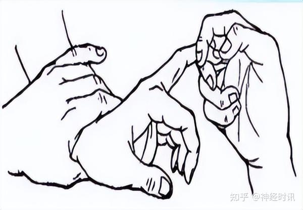 临床必备 | 神经系统体格检查，一文详解！ - 知乎