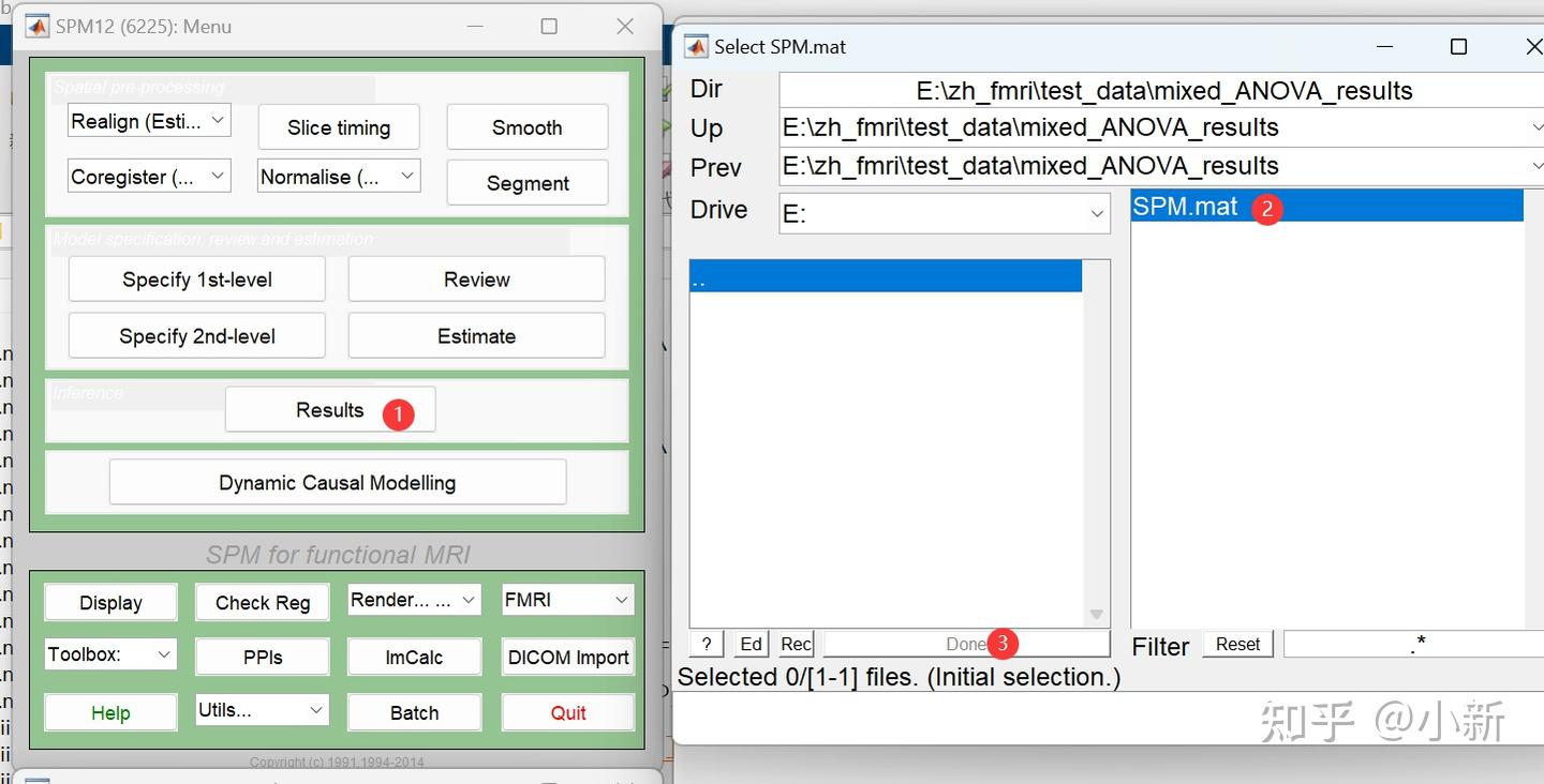 14（1）-SPM-fmri任务态二阶分析:多重比较校正FWE&FDR - 知乎