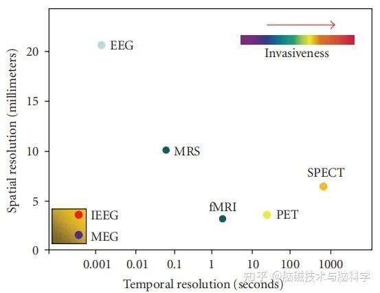 什么是脑磁图（MEG）？ - 知乎