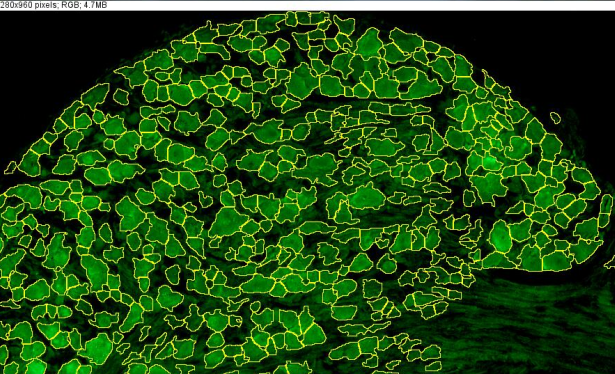 Imagej图像处理实践（ImageJ学习-图像处理 545367350） - 知乎