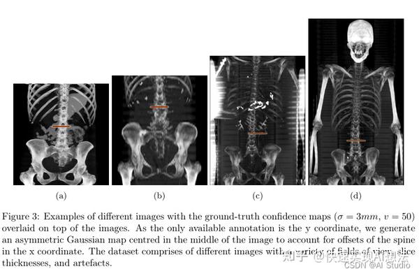 『医学影像』基于Unet模型实现脊柱CT定位（中） - 知乎