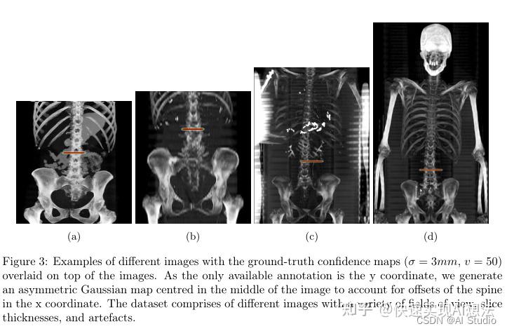 『医学影像』基于Unet模型实现脊柱CT定位（中） - 知乎
