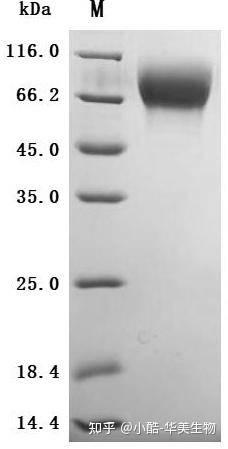 滋养层糖蛋白TPBG：双功能癌胚抗原，肿瘤ADC或疫苗新靶点！ - 知乎