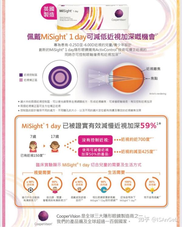 Misight真的有用!!! - 知乎
