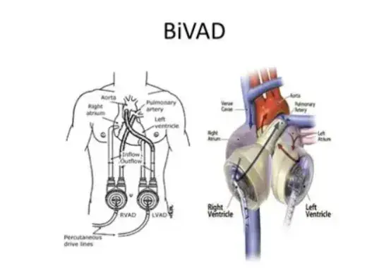 心闻5分钟丨全球首例跨洲机器人“远程心脏手术”成功完成；同心医疗获超亿美元战略融资…… - 知乎
