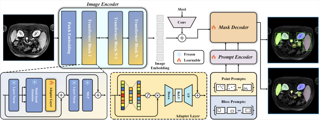 SAM-Med2D：打破自然图像与医学图像的领域鸿沟，医疗版 SAM 开源了！ - 知乎