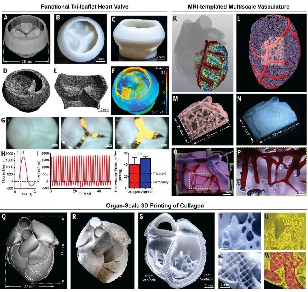 《Science》重磅： 从毛细血管到整个心脏！3D打印胶原蛋白助力重建心脏 - 知乎