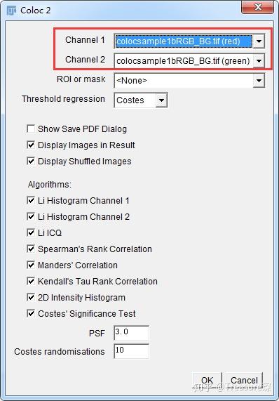ImageJ实用技巧——荧光共定位分析(定量分析篇) - 知乎