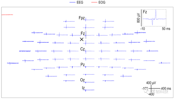 rt-TEP工具：实时显示TMS诱发电位，最大化皮层激活和最小化伪影 - 知乎