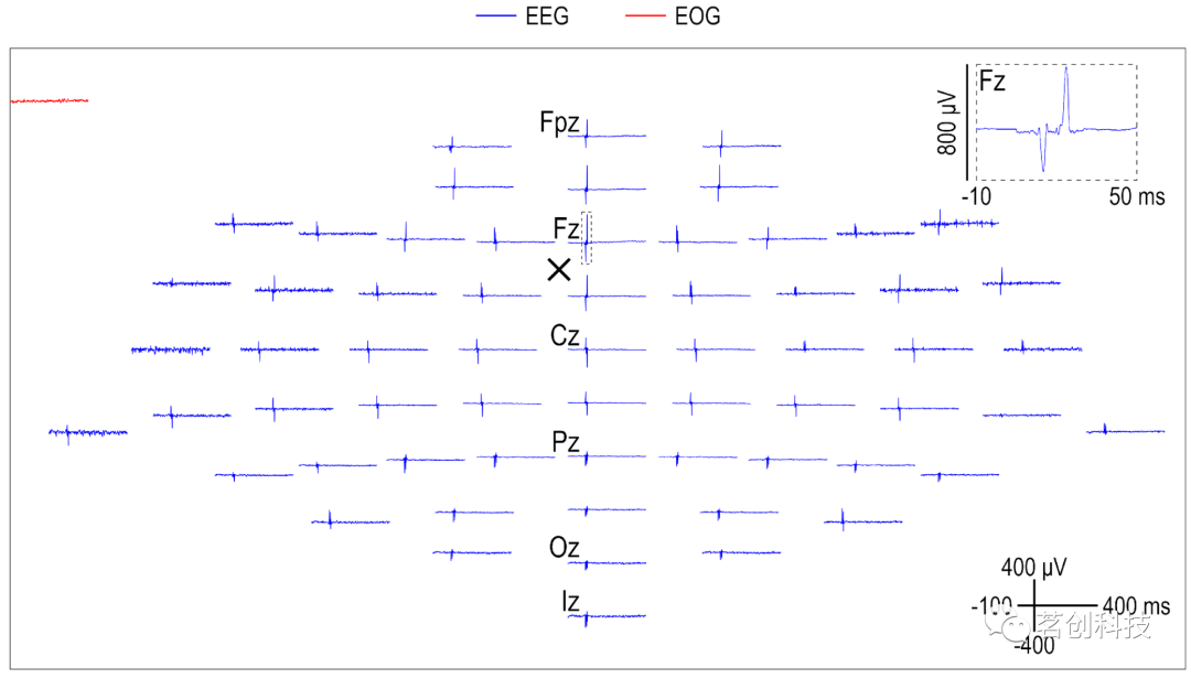 rt-TEP工具：实时显示TMS诱发电位，最大化皮层激活和最小化伪影 - 知乎