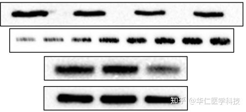 科研小白的进阶之路（1）——Western Blot实验教程 - 知乎