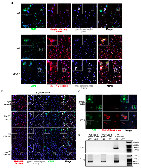 Nature子刊丨通过 C 型凝集素受体进行的肺泡巨噬细胞代谢编程可防止脂肪毒性和细胞死亡 - 知乎