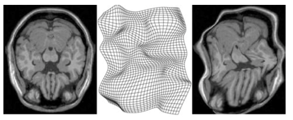 Deformable image registration using convolutional neural network笔记 - 知乎