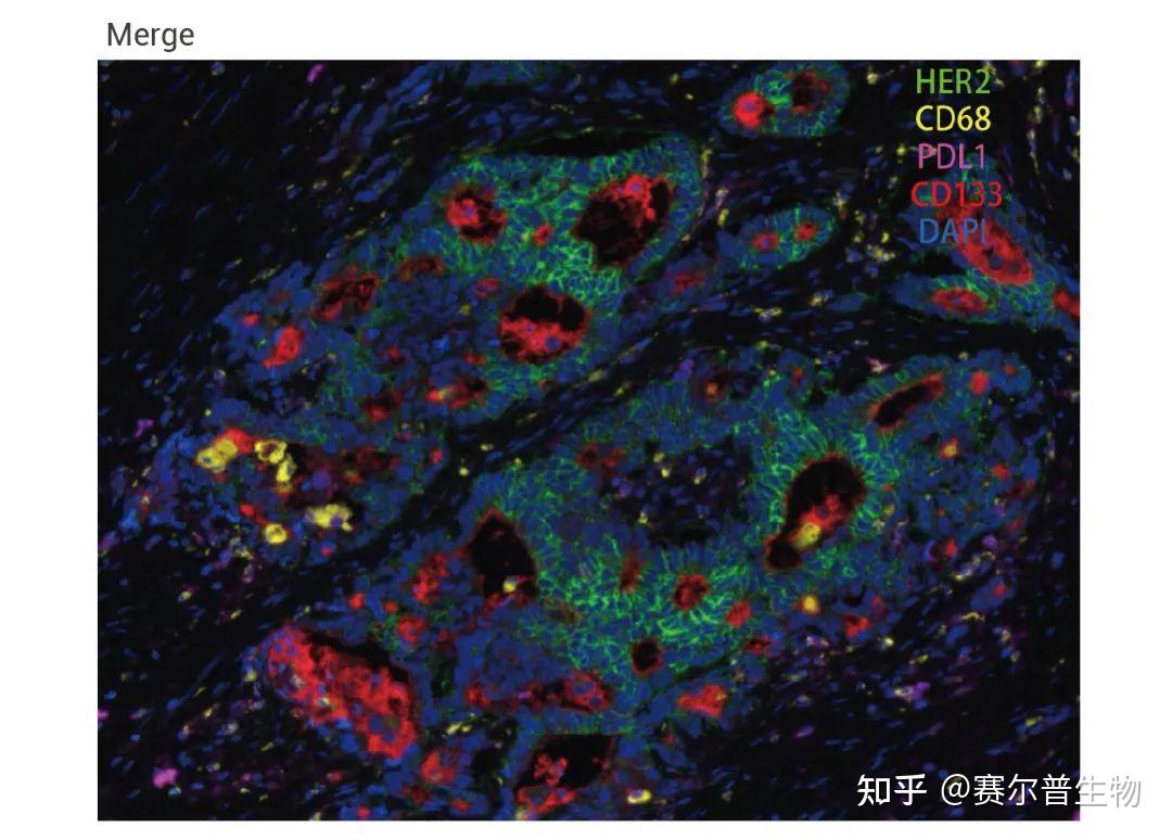 肿瘤免疫学研究新工具：多重免疫组化(mIHC) - 知乎