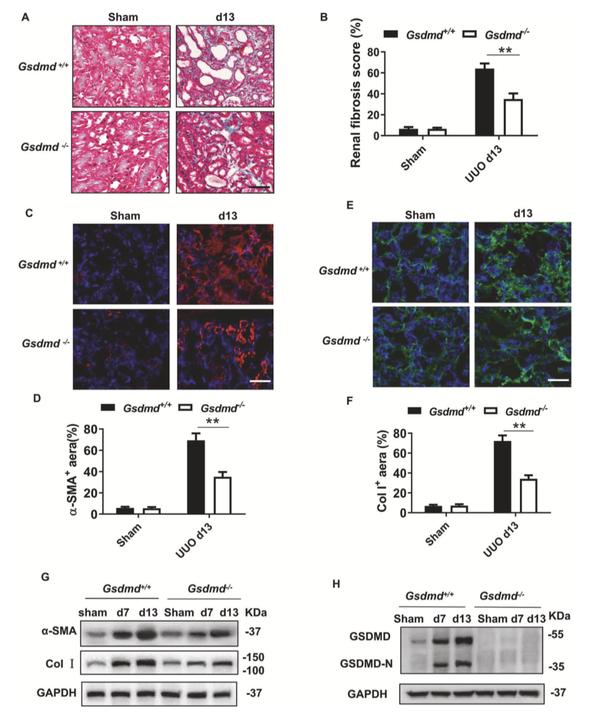 CDD丨GSDMD依赖性中性粒细胞胞外陷阱促进阻塞性肾病中巨噬细胞向肌成纤维细胞的转化和肾纤维化 - 知乎