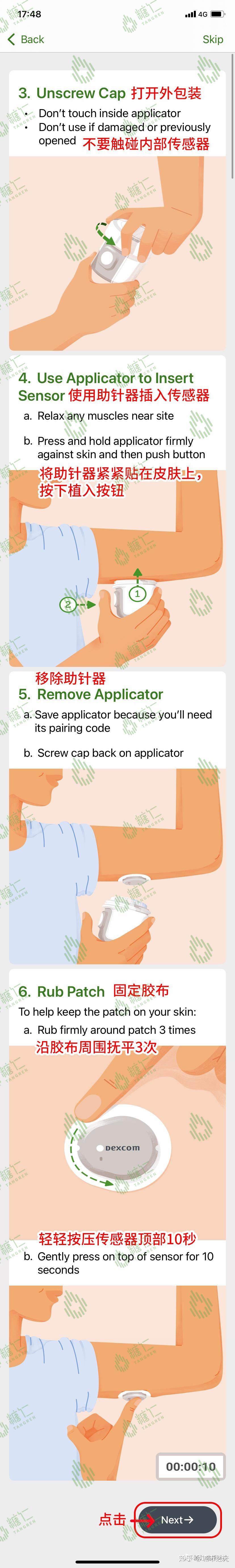 【德康G7】Dexcom G7安装配置教程 - 知乎