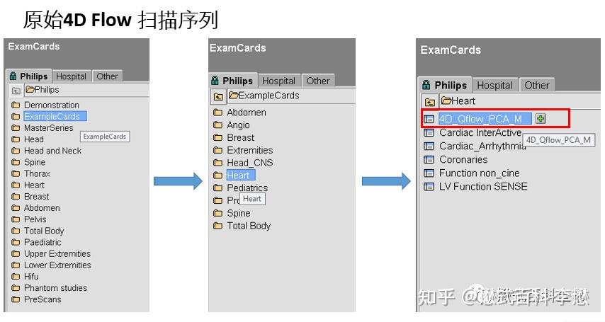 4D-Flow扫描数据采集：序列及参数 - 知乎