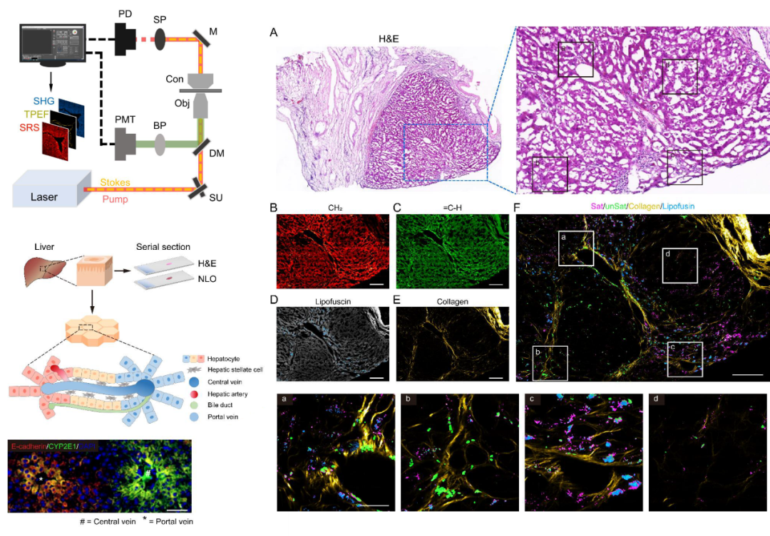 Sci Adv | 岳蜀华/王韫芳发现肝纤维化的潜在治疗靶点 - 知乎
