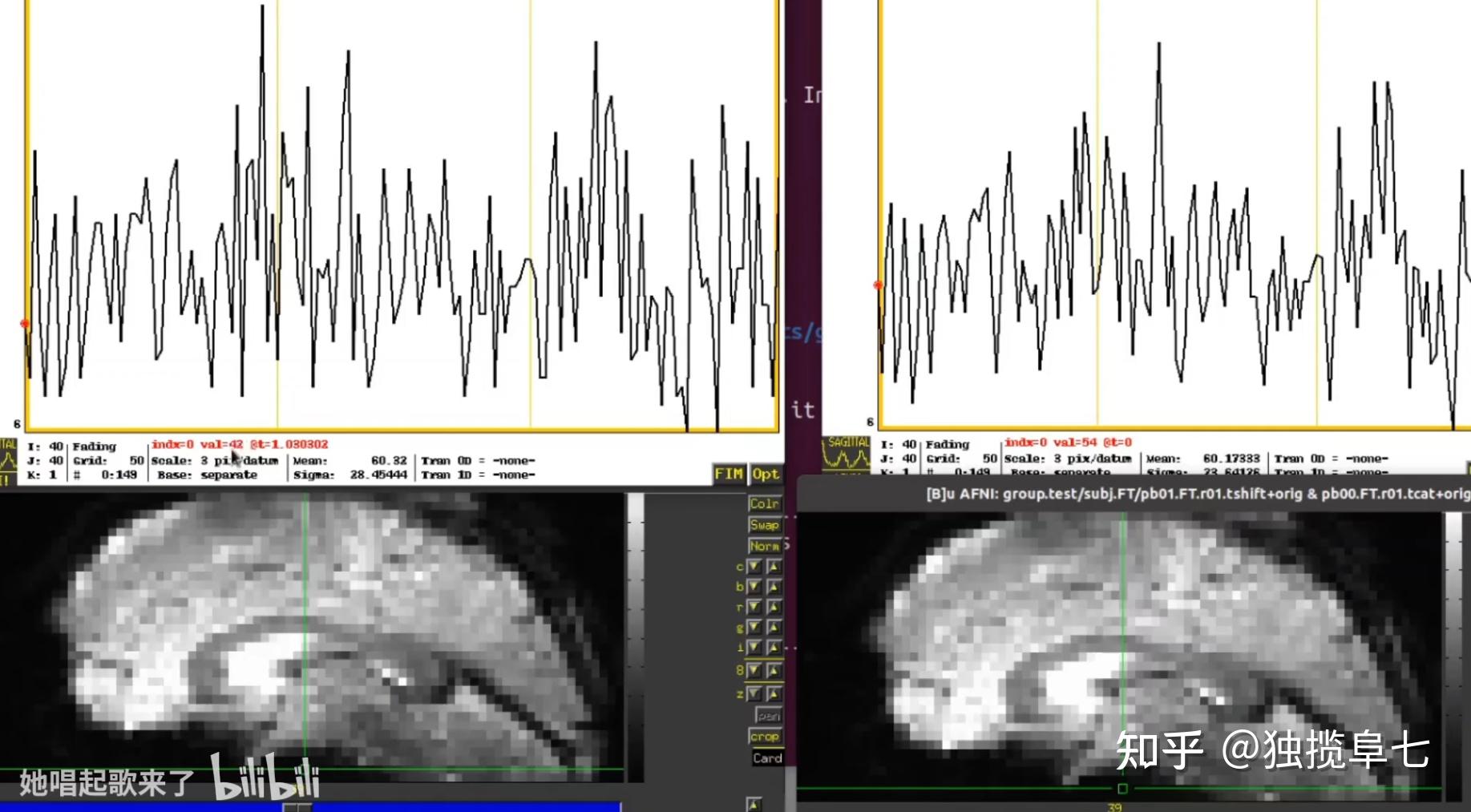 用AFNI处理fMRI数据 - 知乎