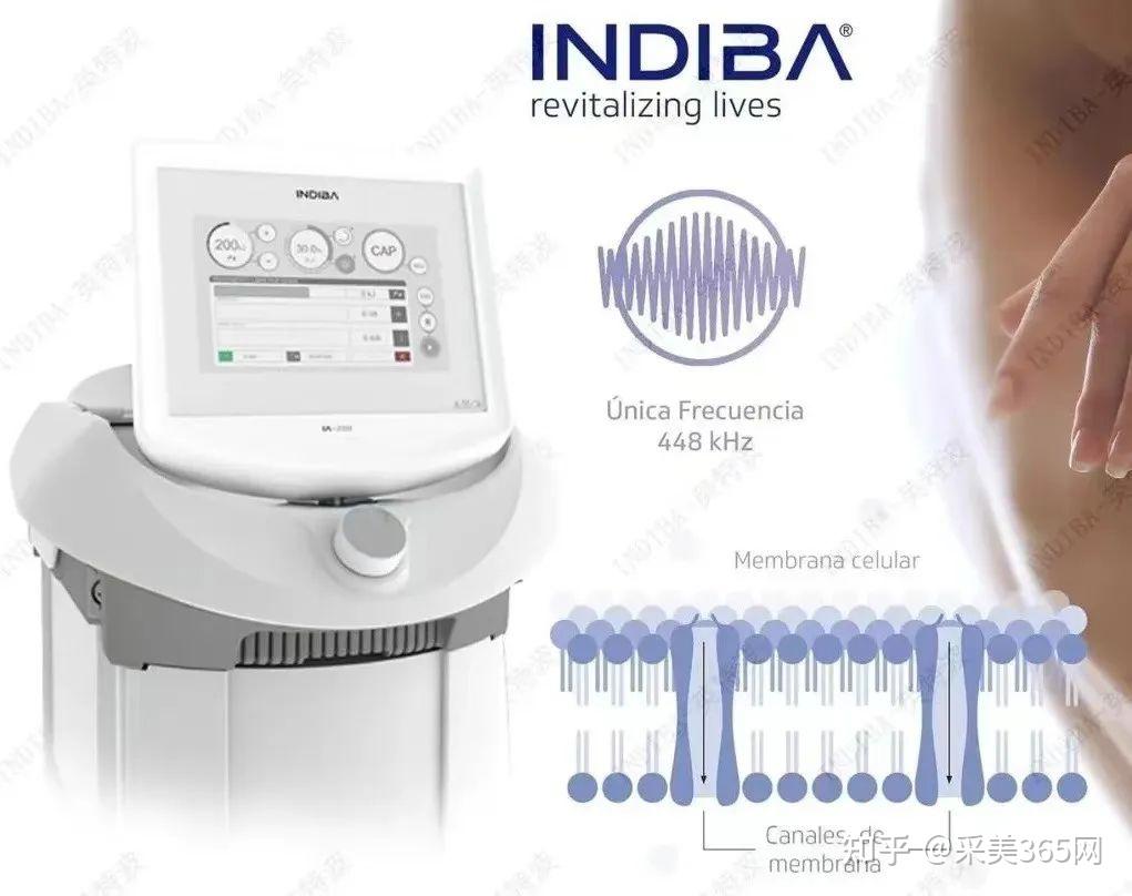 采美推荐 | 欧美高端理疗仪：INDIBA®英特波®/西班牙ROSS/Cell-Life细胞热能仪/WINBACK 3SE - 知乎