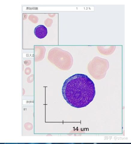 病例分享 - 知乎