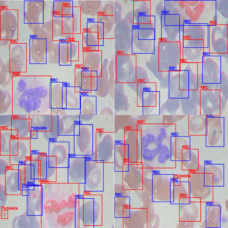在自定义数据集上训练RetinaNet（ 基于PyTorch ） - 知乎