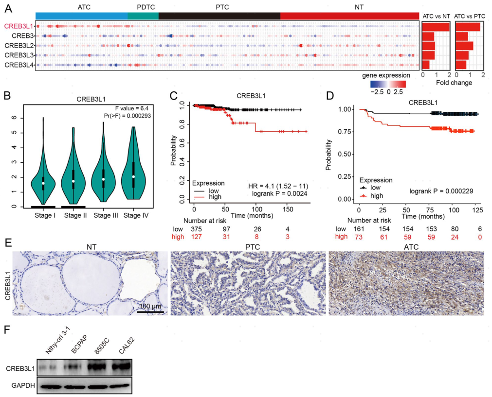【IF=41】单细胞技术揭秘CREB3L1促进间变性甲状腺癌的生长和转移 - 知乎