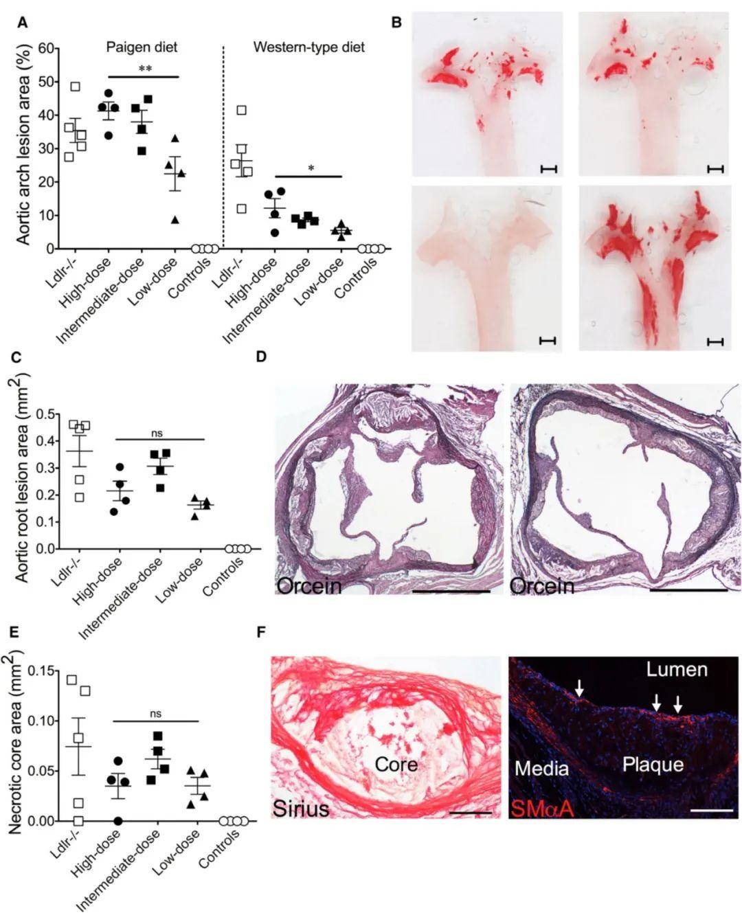 【新品推荐】AAV-PCSK9构建动脉粥样硬化模型 - 知乎